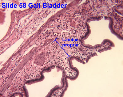 Gallbladder Slide